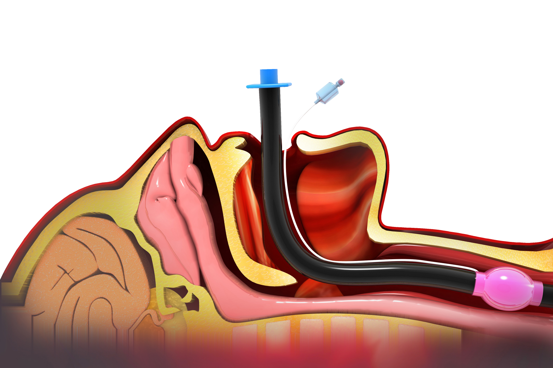 Human Factors and Anaesthetic Practice: Why the Equipment Makes a ...